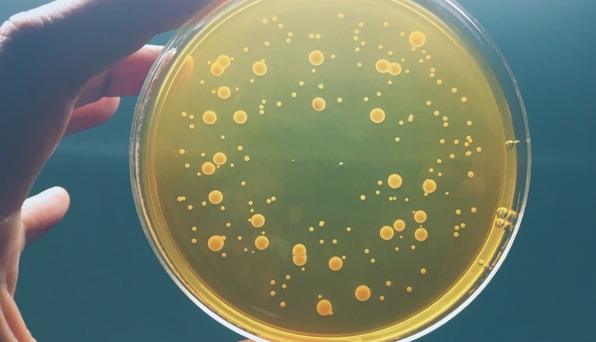 Total Aerobic Microbial Count (TAMC)