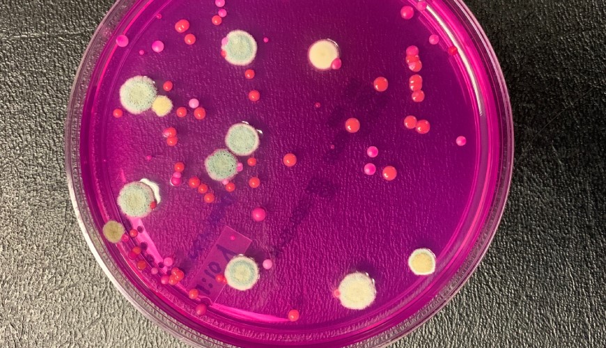 Total Yeast and Mold Count (TYMC)